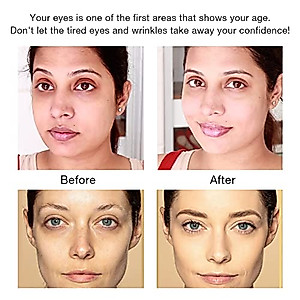 Eye Beauty Instrument, Eye RF Anti Aging Device | Eye Bags | Puffiness | Dark Circles | Crow's feet | Fine Lines | Wrinkles Removal Device, Home Radio Frequency Anti Aging Beauty Instrument for Eyes