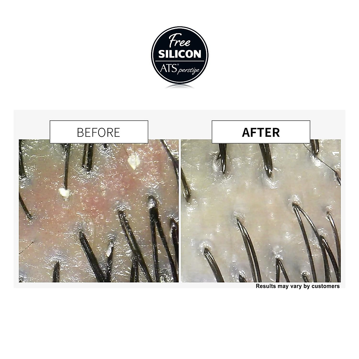 ATS Perstige Bresh Shampoo - 600ML, Oily Scalp and Soothing Silicone Free Shampoo