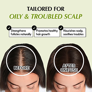 RATED GREEN REAL MARY Energizing Biotin Hair Growth Spray for Thinning Hair and Scalp for Men & Women - Rosemary and Ginger Scalp Spray | 4.06 fl oz