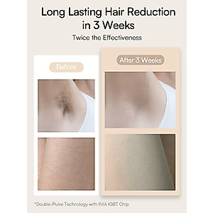 INIA Laser Hair Removal for Women and Men, IPL Hair Removal Device with Sapphire Ice-Cooling, Double Effectiveness & 5 Flashes per Second for Long-Lasting and Nearly Painless Results