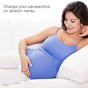 Mederma Stretch Marks Therapy, Hydrates to Help Prevent Stretch Marks, Clinically Shown to Produce Noticable Improvement in 4 Weeks, Dermatologist Recommended, Ivory, 5.29 Ounce