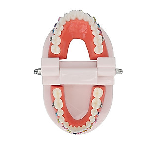 Teeth Model, Dental Teeth Kids Dental Teaching Study Supplies with Metal Bracket Dental Treatment Teeth Model for Dentist Research Dental Laboratory Fake Teeth Braces
