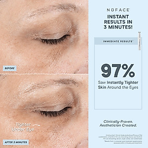 NuFACE FIX Line Smoothing Starter Kit - FDA Cleared Microcurrent Device + Serum Activator for On-The-Go Treatment of Forehead Lines, Crow's Feet, Under Eyes, Smile & Fuller-Looking Lips