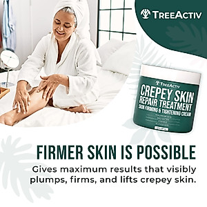 TreeActiv Crepey Skin Repair Treatment, 8oz, Firming Cream For Face and Neck, Skin Firming and Tightening Lotion with Hyaluronic Acid, Crepey Skin Treatment that Moisturizes Dry Crepe Skin, 500+ Uses