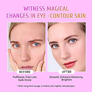 PEAUAMIE Under Eye Patches (30 Pairs) Gold Eye Mask and Hyaluronic Acid Eye Patches for puffy eyes,Rose Eye Masks for Dark Circles and Puffiness under eye treatment skin care products…