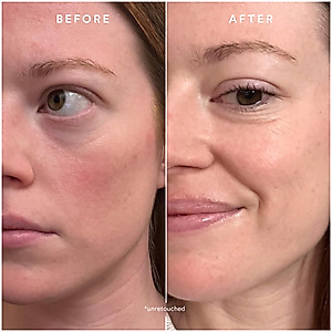 True Botanicals Chebula Extreme Cream | Anti-Aging Moisturizer w/Hyaluronic Acid | Treats Fine Lines & Wrinkles | Dry & Sensitive Skin | Dermatologist Tested, All Natural, Vegan | 1.7 oz | 50 ml