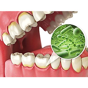 Miracle Write Smile - Essential Oxygen Rinse Mouthwash for Whiter Teeth, Fresher Breath, and Healthier Gums, Peppermint 12 fl. oz