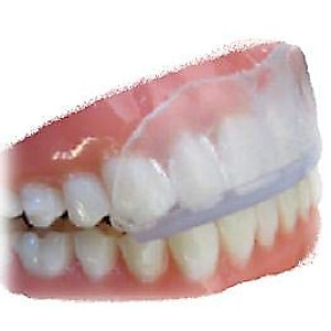 SmartGuard Dental Guard Night Guard for Clenching, Bruxism, and Grinding Dentist Designed Includes 2 Guards, 1 Travel Case, and a 60-Day Supply of Premium Cleaning Crystals