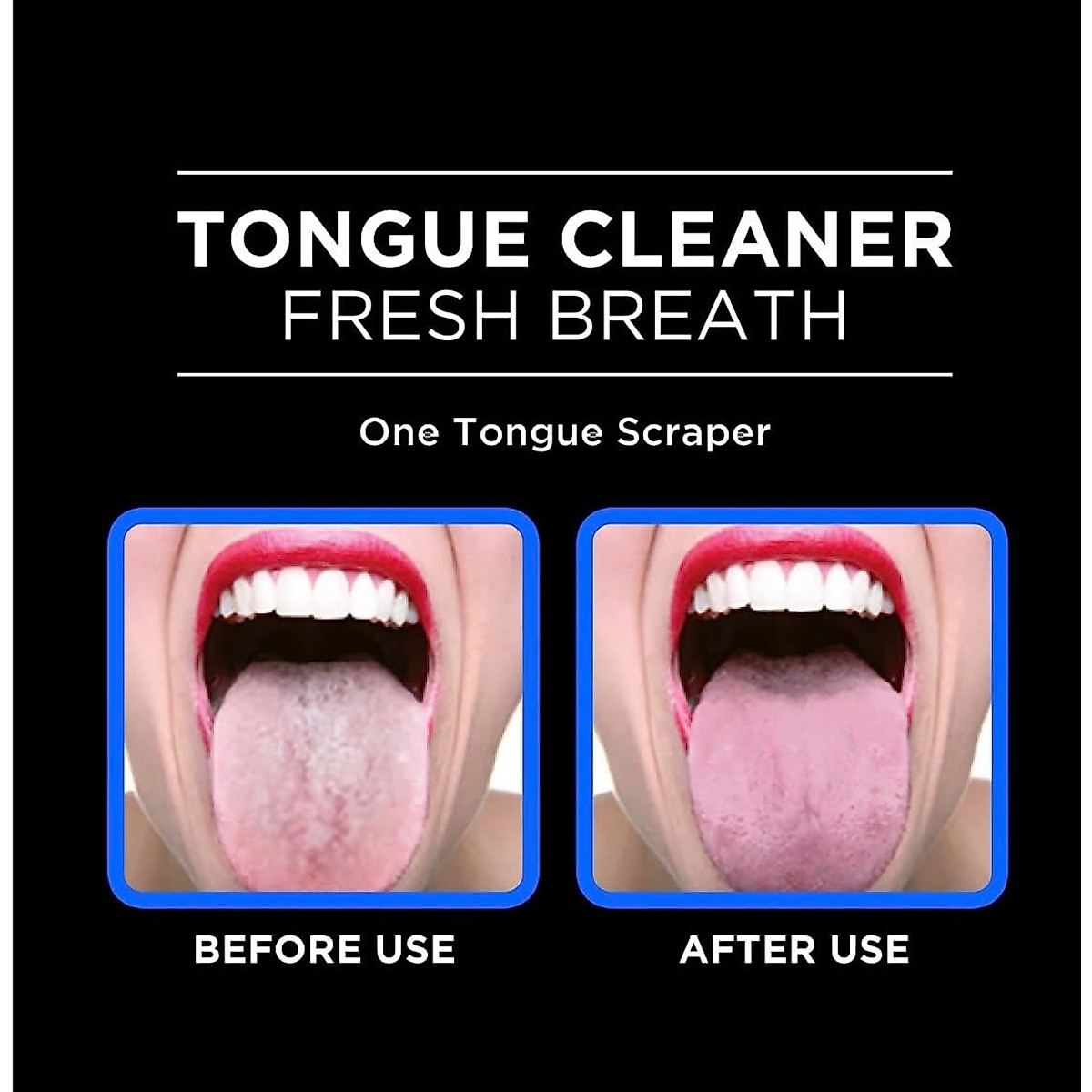 5 Pack Tongue Scraper Brush, Tongue Scraper, Tongue Cleaner, Tongue Brush, Tongue Scraper Cleaner, Tongue Brushes, Helps Fight Bad Breath, 5 Tongue Scrapers