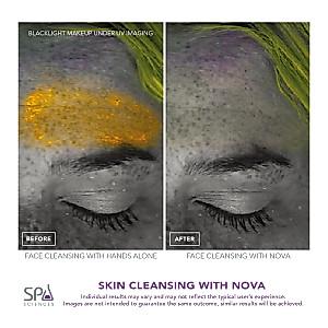 Spa Sciences - NOVA - Sonic Cleansing Brush with Bristles & Infusion System – Anti-Aging Facial Exfoliating, Waterproof, and USB Rechargeable