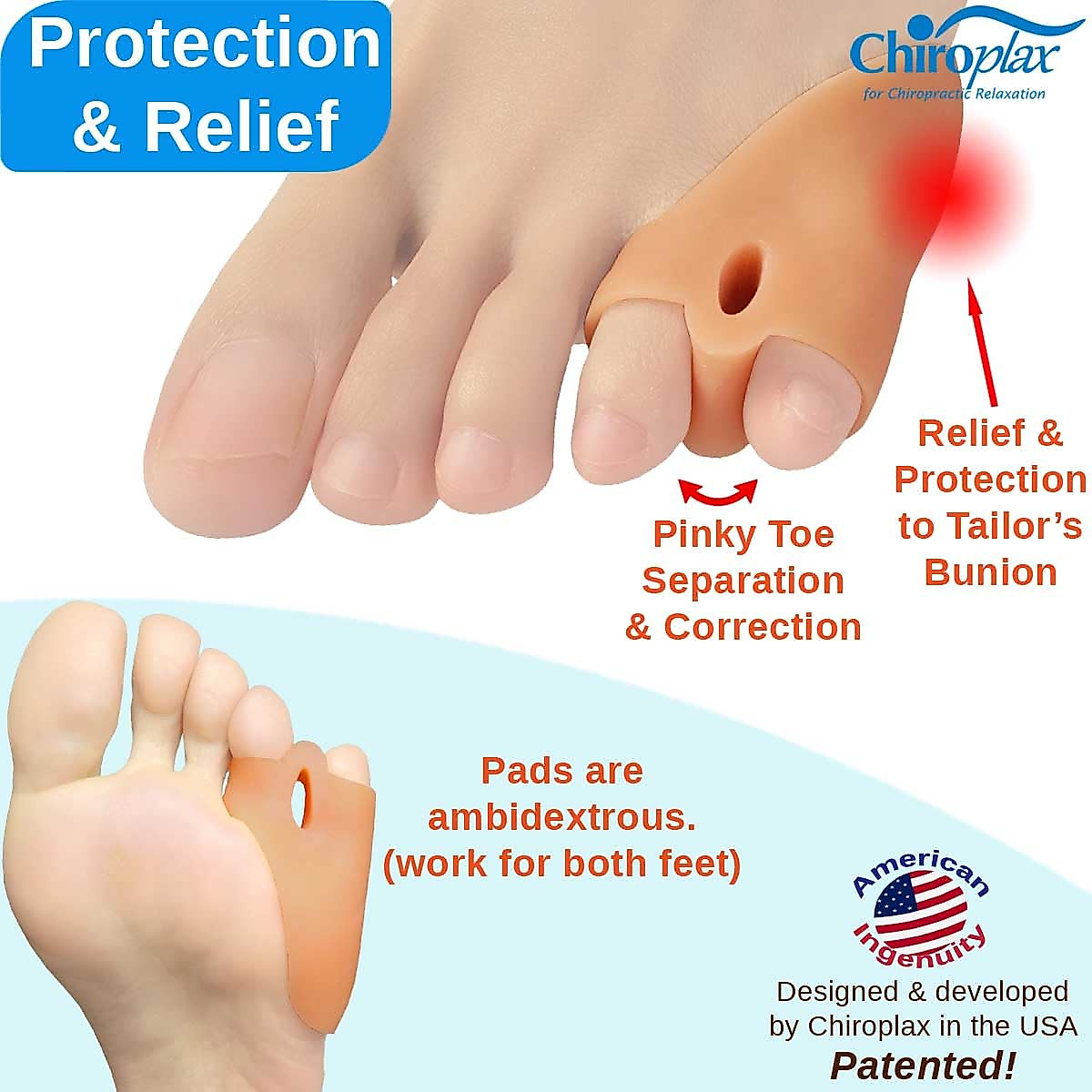 Chiroplax Tailor's Bunion Corrector Pads Bunionette Pain Relief Pinky Little Toe Straightener Separator Cushion Splint Protector Shield Spacer Cover Guard (4 Pads, Shims -Small)