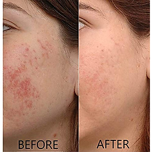 Vitamin C Serum 20% Pure L-Ascorbic Acid, Ferulic Acid, Vitamin E and HA and Hyaluronic Acid Serum with Vitamin B5 for Face and Eyes Natural Anti Aging Anti Wrinkle Set of 2 by Dr. Brenner