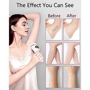 At Home Laser Hair Removal for Women and Men Upgraded to 999,900 Flashes - ProCIV IPL Permanent Hair Removal Painless Hair Remover Device for Whole Body