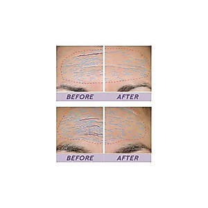 MARY KAY TIMEWISE REPAIR VOLU-FIRM LIFTING SERUM, 1 FL. OZ. / 29 mL NIB