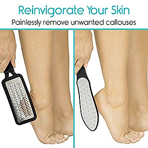 Vive Foot File (3 Pack) - Callus Remover Pedicure Tool Kit for Men, Women Care - Dead Skin Heel Scrub Shaver and Rough Patch Eliminator Remover for Dry and Wet Toe and Feet Peel - Rasp Scrubber Blade