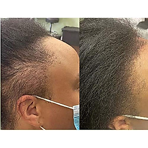 Infinix 2 BOTTLE COMBO Thick and Full Black Rice Oil for powerful Hair growth Biotin &Peppermint oil