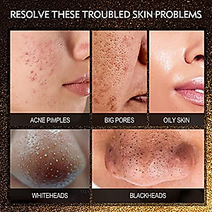 Blackhead Remover Mask, 3-in-1 Peel off Face Mask with 24K Gold Serum & Silicon Brush,24K Gold Facial Mask For Deep Cleansing Blackhead, Whitehead, Pores, Acne, Oil, Peel Mask Black Mask(80g+20ml)