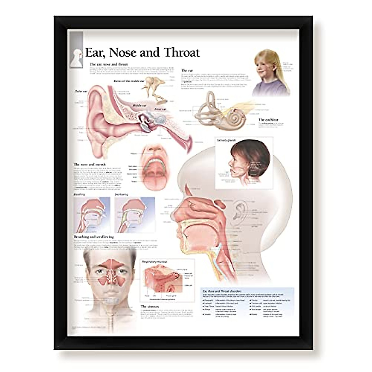 Set of 4 Framed Medical Posters Ear, Nose and Throat, Understanding Sinusitis, Understanding Rhinitis, and Middle Ear Infections 22"x28" Wall Diagrams