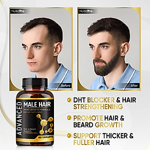 Hair Growth Vitamins For Men-Anti Hair Loss Support Vitamins Pills & Dht Blocker For Men.Regrow Hair & Beard Growth Supplement For Thicker Fuller & Stronger Hair. Support Thinning Hair With Biotin.