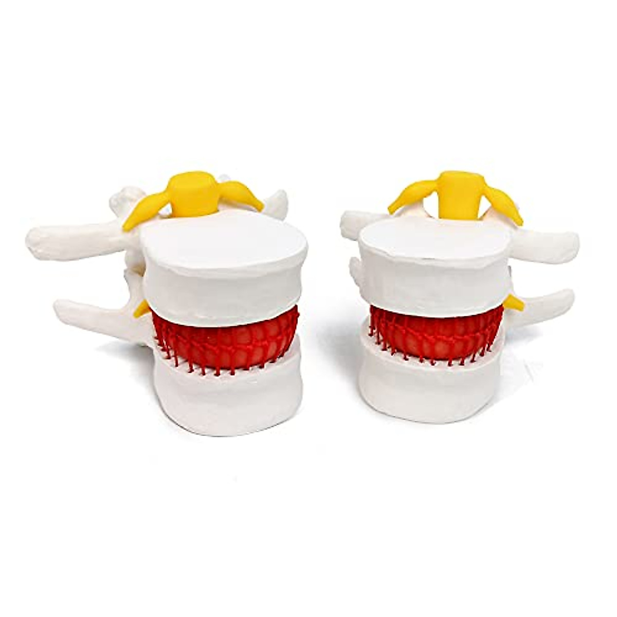 Human Herniated Disc Model, Anatomical Herniated Lumbar Vertebrae Disc Prolapse Model for Medical Teaching Learning, Education Display Tooling, Kids Learning Education Display Tool 2 Pack