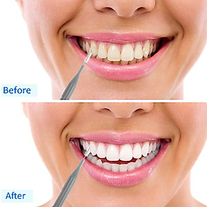 Patelai 100 Pieces Braces Brush for Cleaner Interdental Brush Toothpick Dental Flossing Head Oral Hygiene Flosser Tooth Cleaning Tool (Stylish Colors)