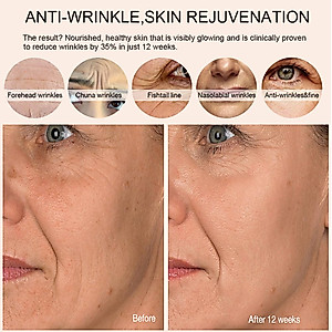 NEWKEY Red Light Therapy Mask for Face Wrinkles, LED Face Mask Light Therapy,7 Colors Photon Red Light Therapy Mask for Face, 20 Minutes Treatment,Adjustable Strap,Plug-in