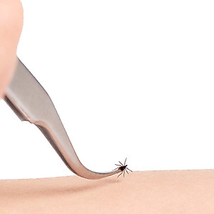 Tick Killer Platinum Tick Removal Tool Set, Stainless Steel Tick Remover Tweezers Kit, Protective Metal Case, Identification Card & Plastic Mini Bags