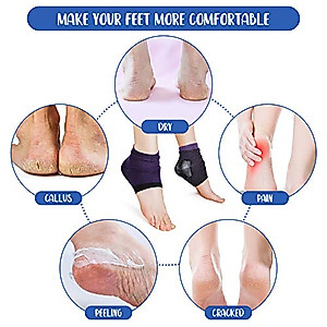 12 Pairs Cotton Heel Moisturizing Socks Open Toe Socks Cracked Gel Heel Socks Foot Toeless Heel Repair Socks for Women Girls Dry Hard Cracked Feet (Bright Color)