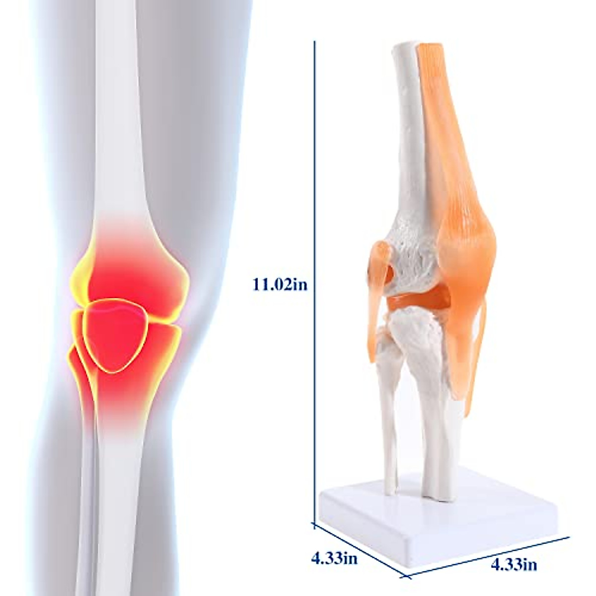 ASINTOD Anatomical Medical Knee Joint with Ligaments Model, Human 1:1 Life Size, for Science Classroom Study, Display Teaching
