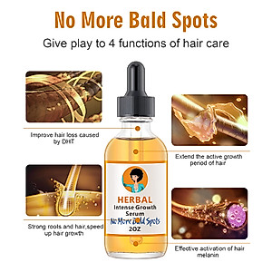 Ginger Hair Growth Serum - Treats Thinning, Hair Loss, Dry & Itchy Scalp, Dandruff - Hair Regrowth Treatment for Men and Women - 2OZ