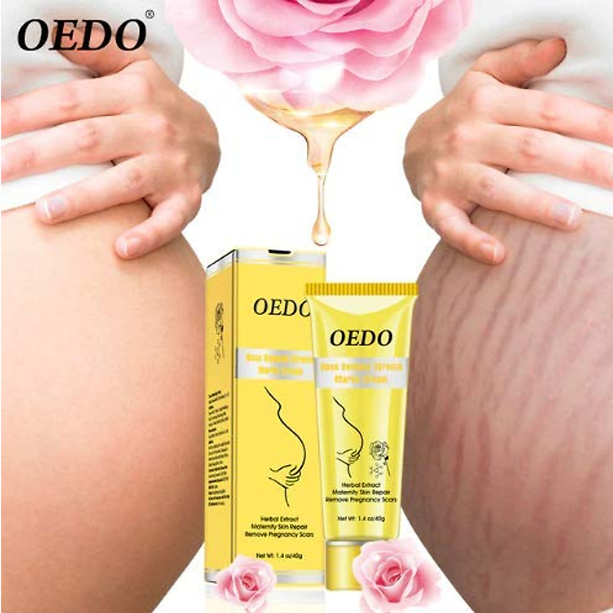 1pcs Remove Stretch Marks Cream Anti Wrinkle Anti Aging Maternity Skin Repair Remove Pregnancy Scars Treatment Body Skin Care