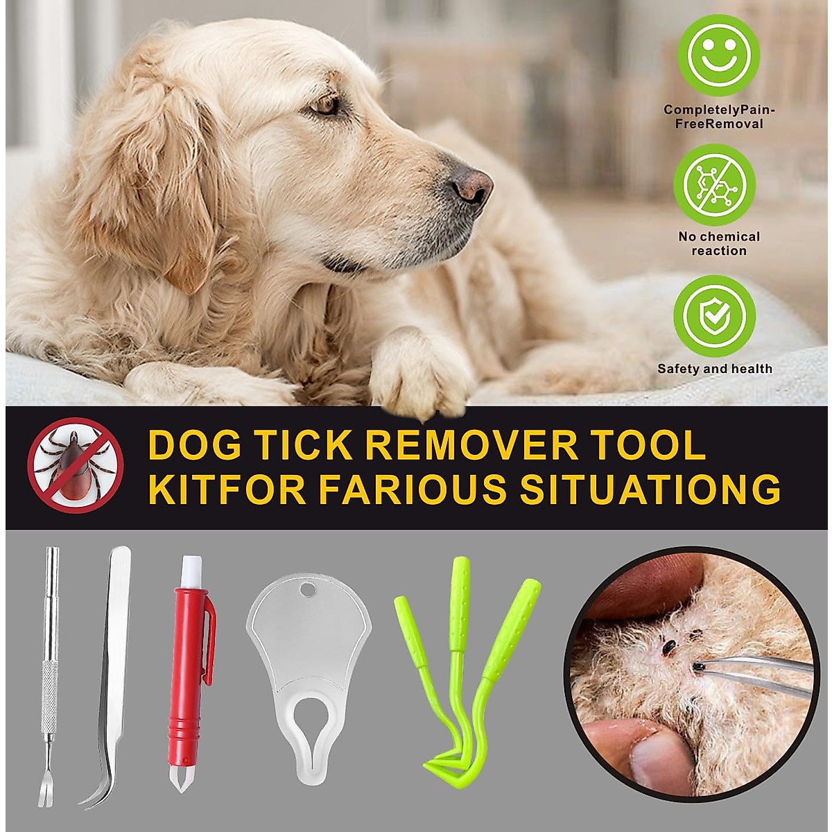 Mrcopetal Tick Remover Tool Kit, Stainless Steel Tick Tweezers + Remover Tick Key, 4 Pack Quick & Safe Tick Twister Removal Tools for Dogs Cats Humans