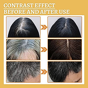 Darka Anti-greying Hair Serum, Darka Pro Anti-greying Hair Serum, Darka Anti Gray Hair Serum, Ganoderma Nutrient Natural Darkening, Regrow Thicker, Fuller, Healthier Hair (5PCS)