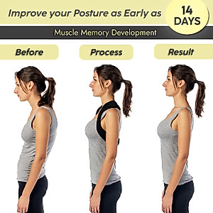 Neck Stretcher & Posture Corrector for Women and Men, FSA HSA Eligible, Cervical Traction for Spine Alignment, Adjustable Upper Back Brace & Elastic Support for Shoulder Back Pain Relief (Dark Blue)