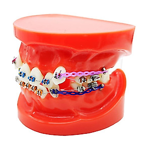 Dental Typodont With Metal Brackets Orthodontic Teeth Model With Ligature Ties Red