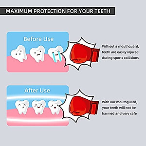 LPONJAR 5 Pack Kids Youth Mouth Guard for Sports, Child Teen Athletic Mouthguard with Case for Football Lacrosse Basketball Taekwondo Boxing MMA Rugby Karate Wrestling