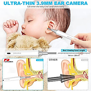 Pancellent Digital Otoscope Camera with Light, Ear Camera and Wax Remover, Video Ear Scope with Ear Wax Removal Tools, Compatible with iPhone, iPad, Android Smart Phone (Basic Edition White)