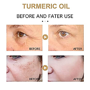 Turmeric Serum Oil Facial Skin Care Serum, Moisturizing the skin Serum, Suitable For Dry Skin, Redness, & Skin Blemishes (colorless 2PC)