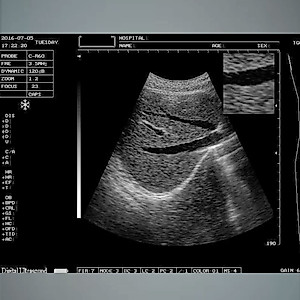 Ultrasound Scanner Veterinary Machine Laptop 12 Inch Portable Black White Doppler Farm Animals Pregnancy Convex Probes, with USB Port, for Animal Horse Equine Goat Dog Cat Sheep Rectal Linear Probe