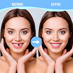 200 Pcs Fake Teeth for Missing Teeth Replacement Repair Kit Tooth Veneer Crown Tooth Replacement it Yourself Front Teeth Dental Veneer with Thermal Beads for Holiday Cosplay