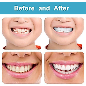 Fake Teeth, Instant Veneers for Temporary Tooth Repair Upper and Lower Jaw, Dentures Teeth Socket-Perfect for Women and Men, Protect Your Teeth and Regain Confident Smile, Natural Shape with Color
