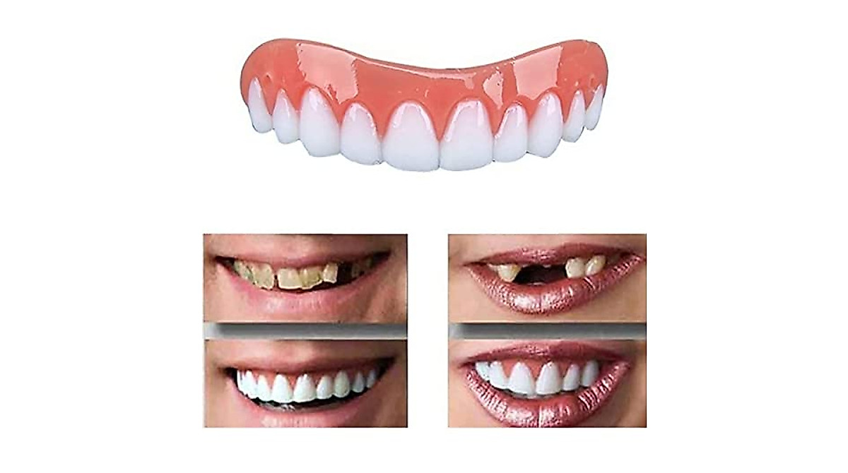 Adjustable Snap-On Dentures for a Natural Smile - Easy & Comfortable