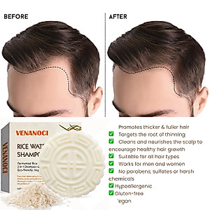 Rice Water For Hair Growth Shampoo Bar, 2 In 1 Fermented Rice Water Shampoo And Conditioner Bar For Hair Growth, Vegan Origin Growth Anti Hair Loss Rice Water Shampoo Bar, Solid Rice Bar Soap For Hair Growth All-Natural