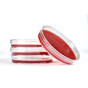 Red Blood Agar (RBA), TSA with 5% Sheep Blood (10-Pack). Pre-Poured, 15x100mm Plates. Used to Detect Hemolysis.