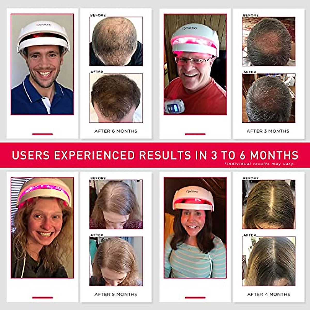 iRestore Essential Laser Hair Growth System - FDA Cleared Hair Loss Treatments for Men & Women & Hair Growth Products for Men with Thinning Hair, Hair Regrowth Treatments Laser Cap, Red Light Therapy