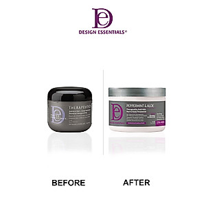 Design Essentials Peppermint & Aloe Therapeutics Anti-Itch Hair + Scalp Treatment Dandruff Hairgrooming, 5 Fl Oz., White