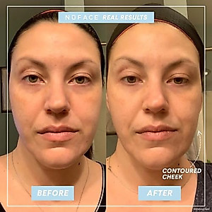 NuFACE MINI Starter Kit ,White