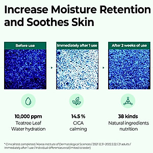 SOME BY MI AHA BHA PHA 30 Days Miracle Serum / 1.69Oz, 50ml / Made from Tea tree Leaf Water for Sensitive Skin/Sebum, Blemish Care and Remove Dead Cells/Facial Skin Care