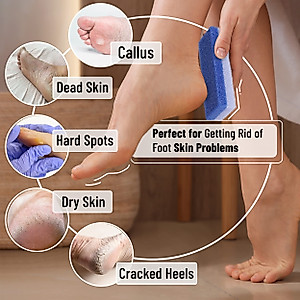 Slick- Pumice Stone for Feet Callus Remover, 4 Pack, 2 Colors, Foot Scrub for Pedicure, Foot Stone Pumice, Callus Remover for Feet, Foot Callus Remover, Feet Scrubber Dead Skin, Foot Pumice Stone