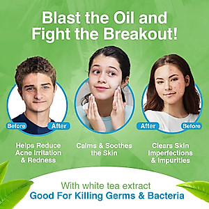 Kidskin Calming Moisturizer, Facial Moisturizing Lotion for Kids 8 and Up, Moisturizer for Dry Skin and All Skin Types, Kids Lotion with White Tea Extract, Gentle Skin Moisturizer, 30 ml